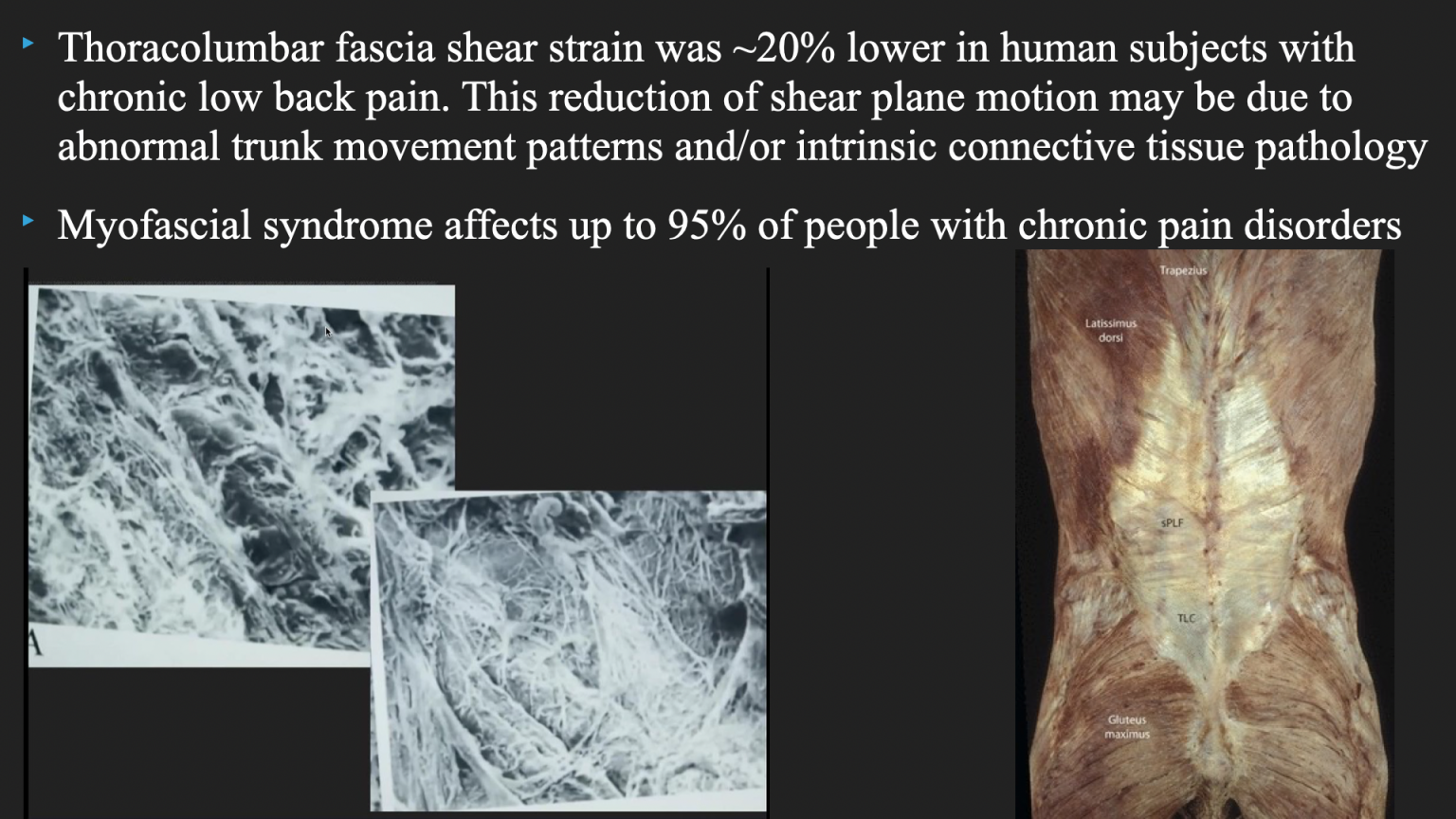 Rethinking Shoulder Mobility: Why Your Hips (and Core) Might Be the ...